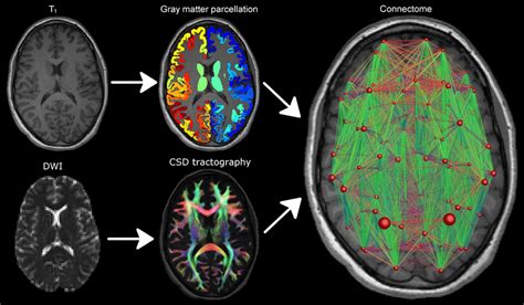 Reconstruction Of The Structural Brain Connectome First A T Download Scientific Diagram