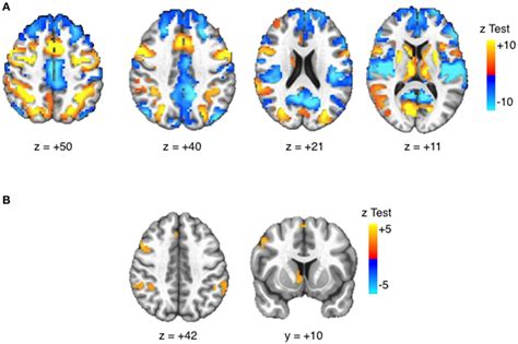 task bold effects activation maps displayed at voxelwise threshold p