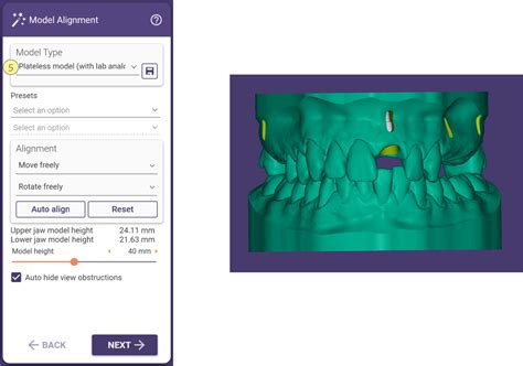 Model Creator Module Exocad