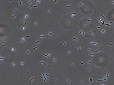 Video Polysome Profiling In Leishmania Human Cells And Mouse Testis