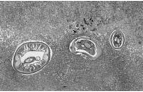 Three Transverse Sections Of D Repens Note The Difference In Diameter Download Scientific