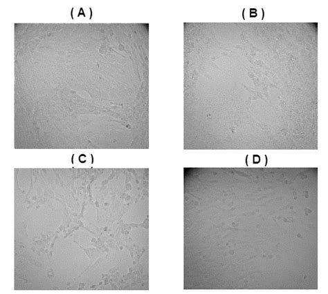 Microphotographs Of Mcf 7 Cell Line After The Cytotoxicity Test A Download Scientific