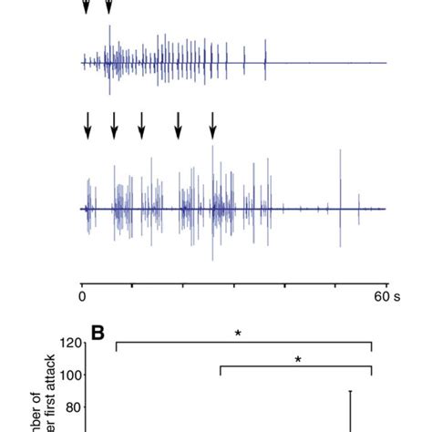 Sound Producing Structures Of Antheraea Polyphemus Larvae A Closeup