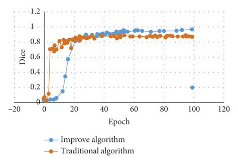 the loss and the dice coefficients of the two densenet network