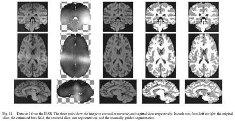 Ieee Transactions On Medical Imaging Tmi On Linkedin Oldiesbutgoodies