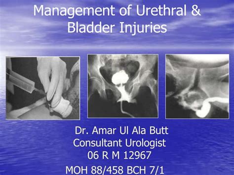 Urethral And Bladder Injury Ppt