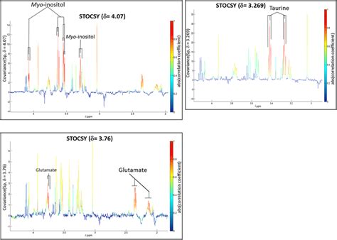Statistical Total Correlation Spectroscopy Stocsy Stocsy Showing