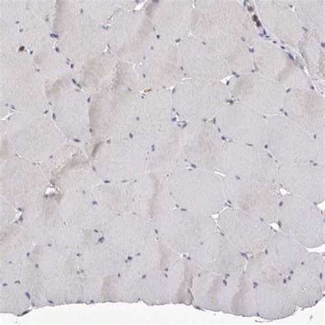 Rabbit Polyclonal Anti Siglec10 Antibody Buy For Research Highly Specific Rigorously