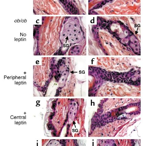 upregulation of dgat2 in the skin of ob ob mice a mrna expression of