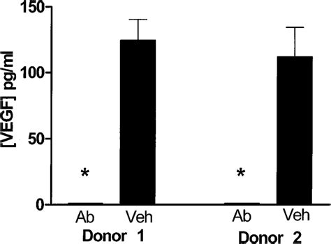 A Platelet Aggregation Curves Associated With 4 Incremental