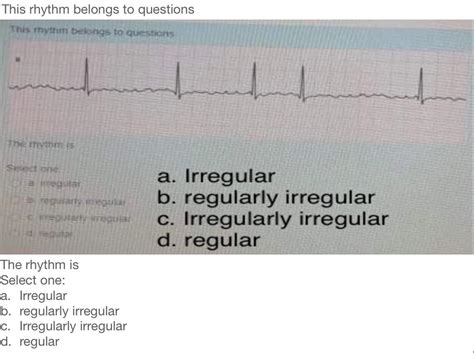 Solved This Rhythm Belongs To Questions This Fryefint