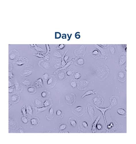 Cd14monocyte Isolation Applied Cells