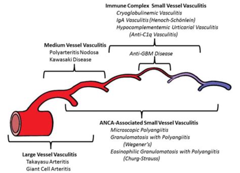 Vasculitis Flashcards Quizlet