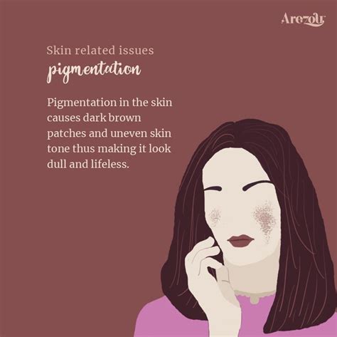 Pigmentation Pigmentation Disorder Pigmentation Treatment Pigment