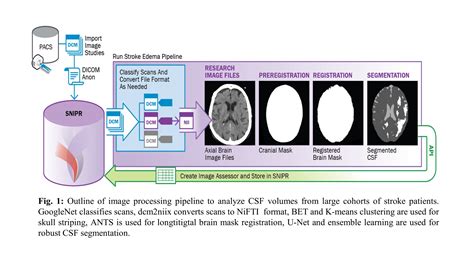 Big Data Approaches To Neuroimaging An Automated Processing Pipeline