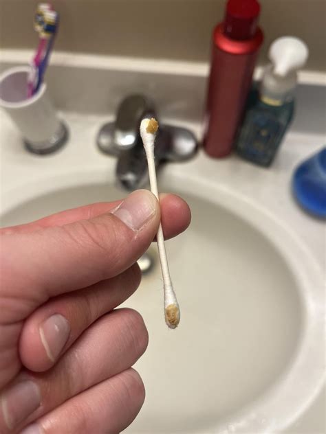 Infected Eardrum And Pus R Earwax