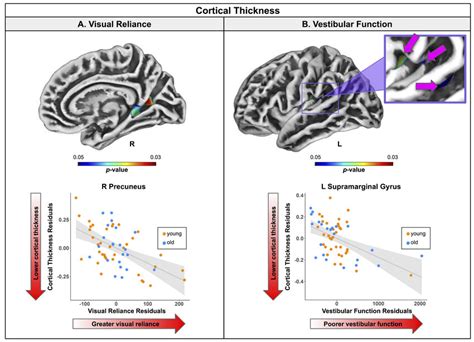 Regions Of Correlation Between Cortical Thickness And Balance Scores Download Scientific