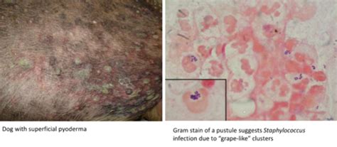 Staphylococcus Flashcards Quizlet