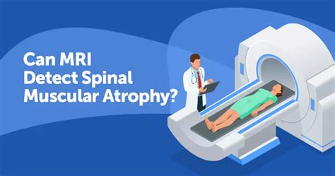 Can Mri Detect Spinal Muscular Atrophy Mysmateam