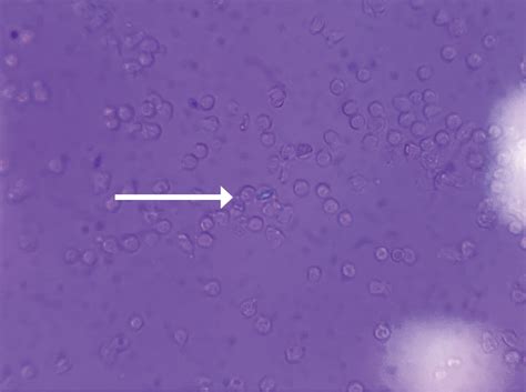 Cppd Crystals