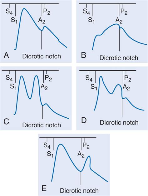 Cardiovascular Physical Examination Clinical Tree