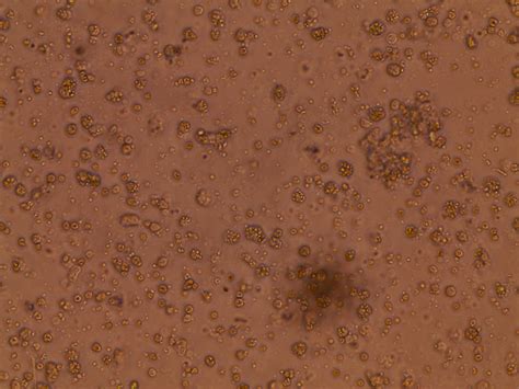 Help Black Round Dots Seen In Cell Culture Yeast Infection