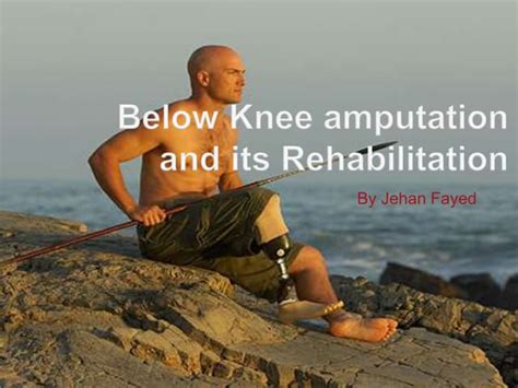 Below Knee Amputation And Its Rehabilitation Pptx