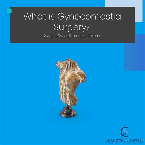 Gynaecomastia Dr Chrysis Sofianos Cs Plastic Surgery