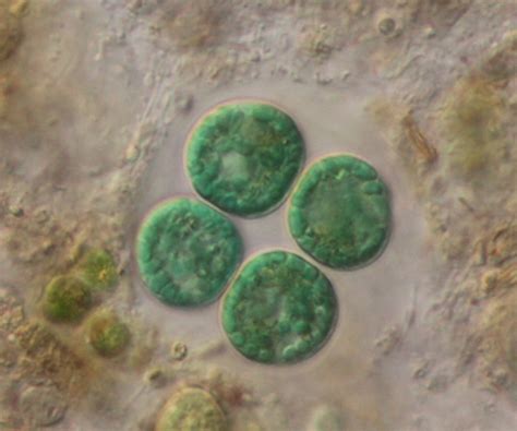 Glaucophyte Algae Glaucophyta Botanical Realm