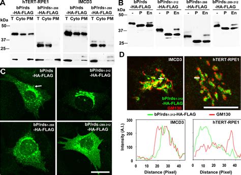 Unconventional Cilia Targeting Of Prds In Imcd3 Cells A