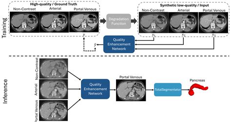 [論文レビュー] Leveraging Multiphase Ct For Quality Enhancement Of Portal Venous Ct Utility For
