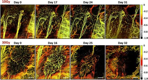 Tumour Microvasculature Images Before Masking Depth Encoded Here For