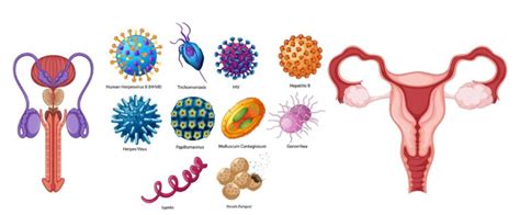 Бэлгийн замын халдварт өвчиний тухай бүгдийг Ирээдүй