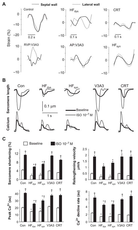 Impact Of Synchronous Dyssynchronous And Resynchronized Hf On Download Scientific Diagram