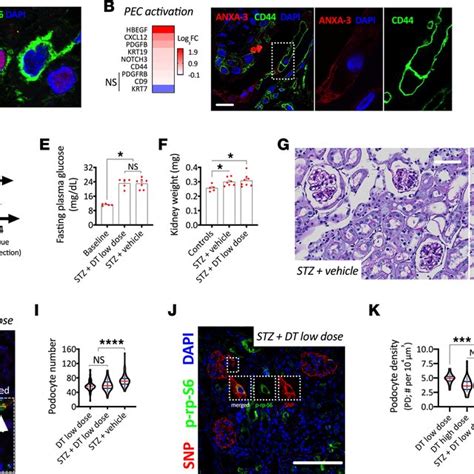 Mtor Mediated Podocyte Hypertrophy During Acute Podocyte Loss A Download Scientific Diagram