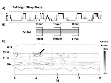 Procedure Employed For The Automatic Spindle Detection A Hypnogram Download Scientific