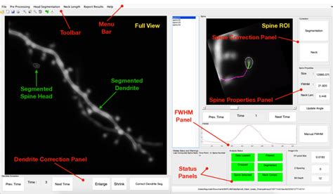 Spines Gui Allows Automatic Analysis Of Dendritic Spines In Combination Download Scientific