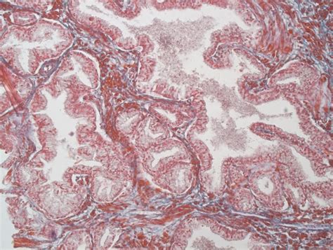 Próstata Atlas Virtual De Histologia