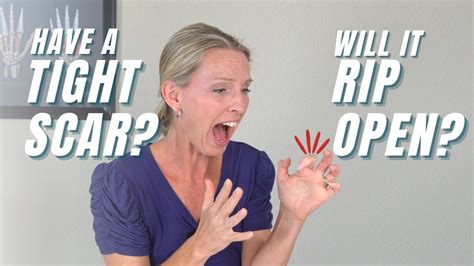 Is Tight Scar Tissue Limiting Movement Of Your Hand Or Finger Get 3
