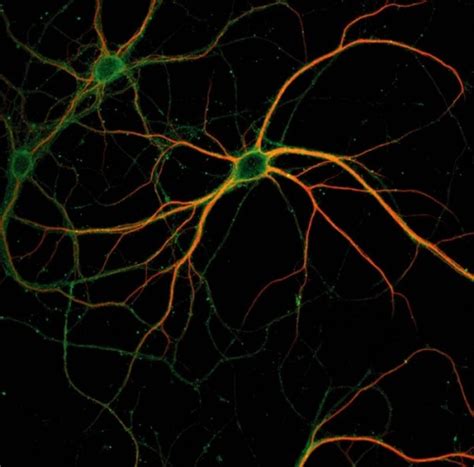 Dendrites On Tumblr