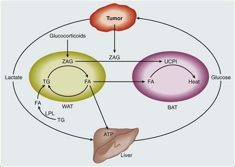 Cancer Cachexia Oncohema Key