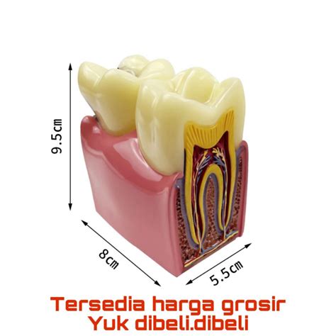 Jual Model Peraga Saluran Akar Gigi Model Study Gigi Shopee Indonesia