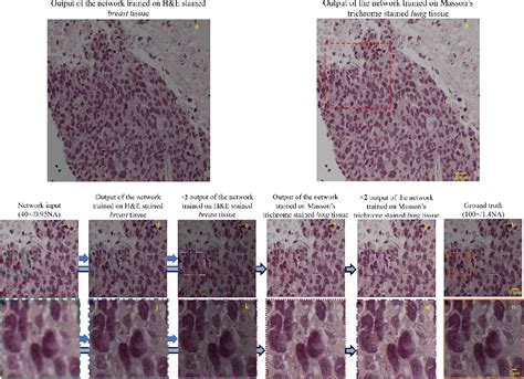 Deep Learning Microscopy