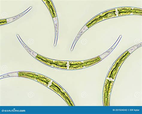 Closterium Sp Charophyta Algae Under Microscopic View X40 Green Algae