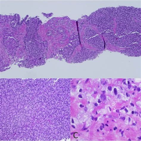 Prostate Mri Images Left Enlarged 13 Cm Right Pelvic Lymph Node Red Download Scientific