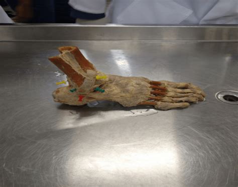 Ligamentos Do PÉ Quiz