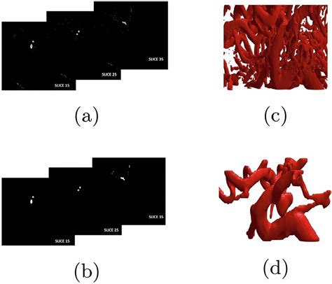 Three Slices From Dataset 2 A Before Segmentation B After