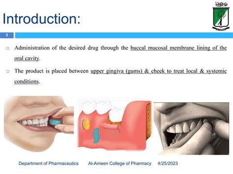 Formulation And Evaluation Of Buccal Drug Delivery Systempptx