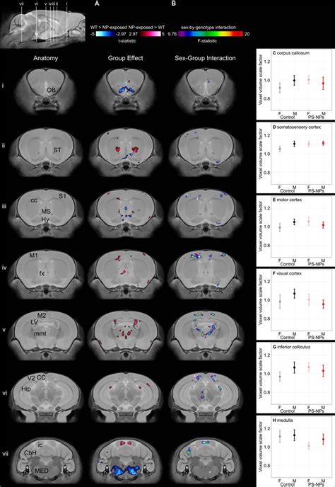 A Representative Coronal Slices Comparing Anatomical Differences In Download Scientific