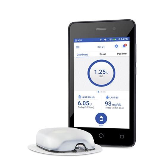 Insulin Pumps And Cgms A Complete Guide For Diabetes Management Us Med